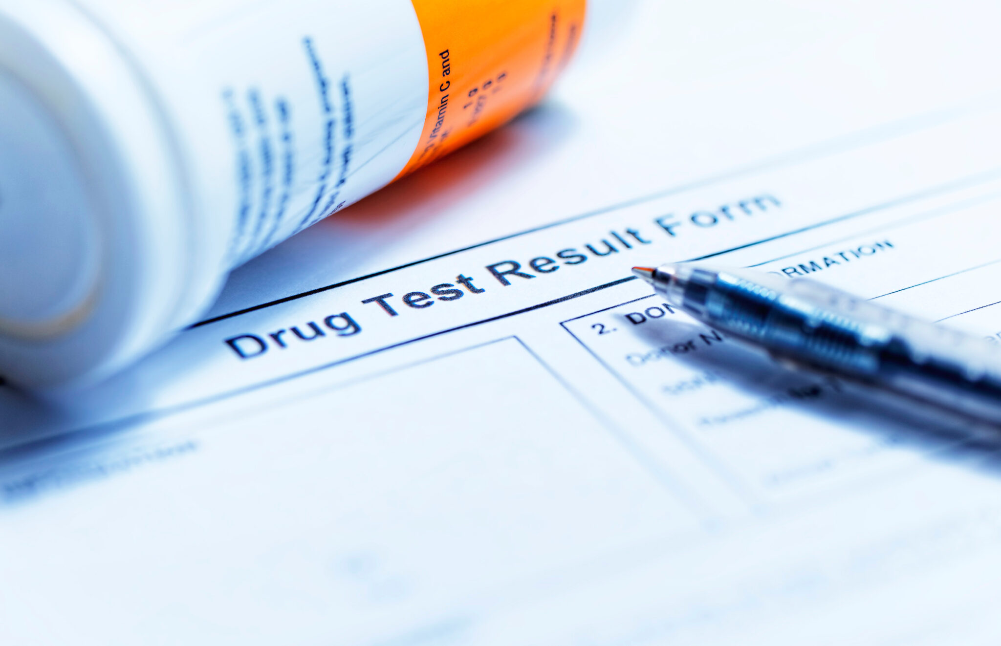 Blood Drug Test Vs Urine: What Drug Test is Right For You?